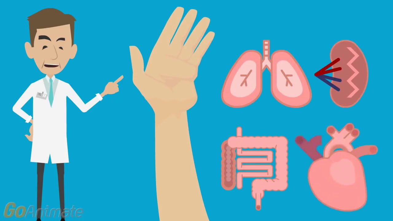 An Overview of Scleroderma Part 1 Breaking it down - YouTube