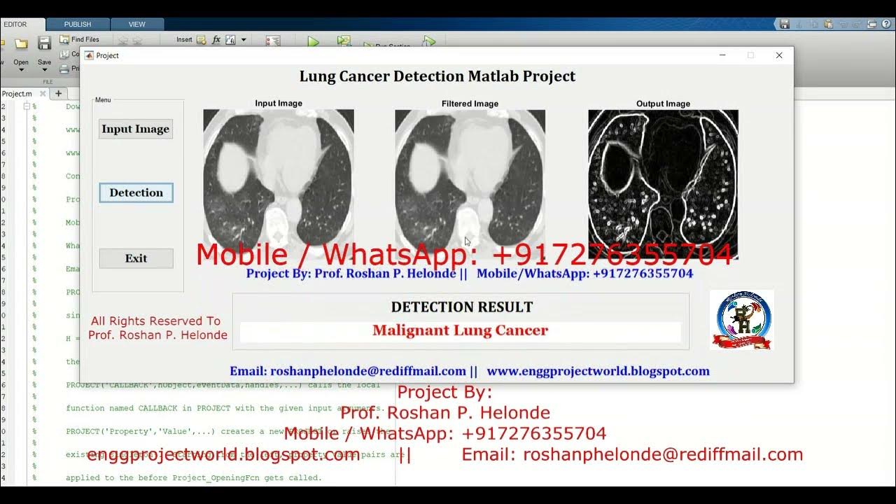Lung Cancer Detection Using Image Processing With Source Code Lung Cancer Prediction Matlab ...