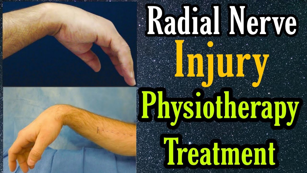 Radial Nerve Injury - Physiotherapy Treatment @geethamihi - YouTube