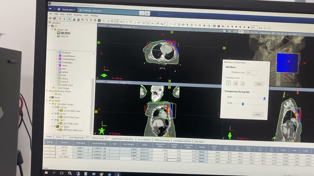 Clinical Implementation of Bolus for Chest Wall Postmastectomy ...