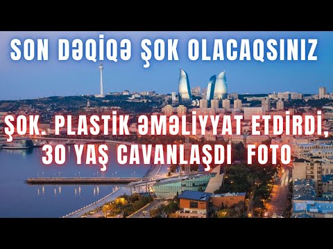 67 yaşlı Xalq artisti plastik əməliyyat etdirdi, 30 yaş cavanlaşdı (FOTO)