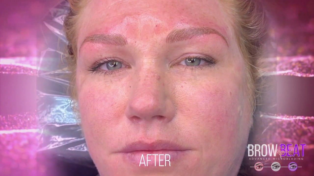 Microblading Treatment BrowBeat Dallas Advanced Microblading Experts ...