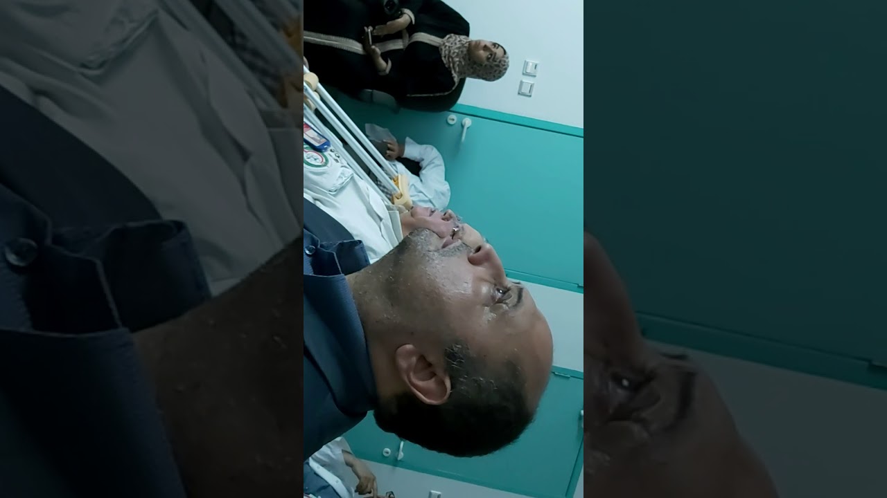 Rare skin disease Myiasis fly - YouTube