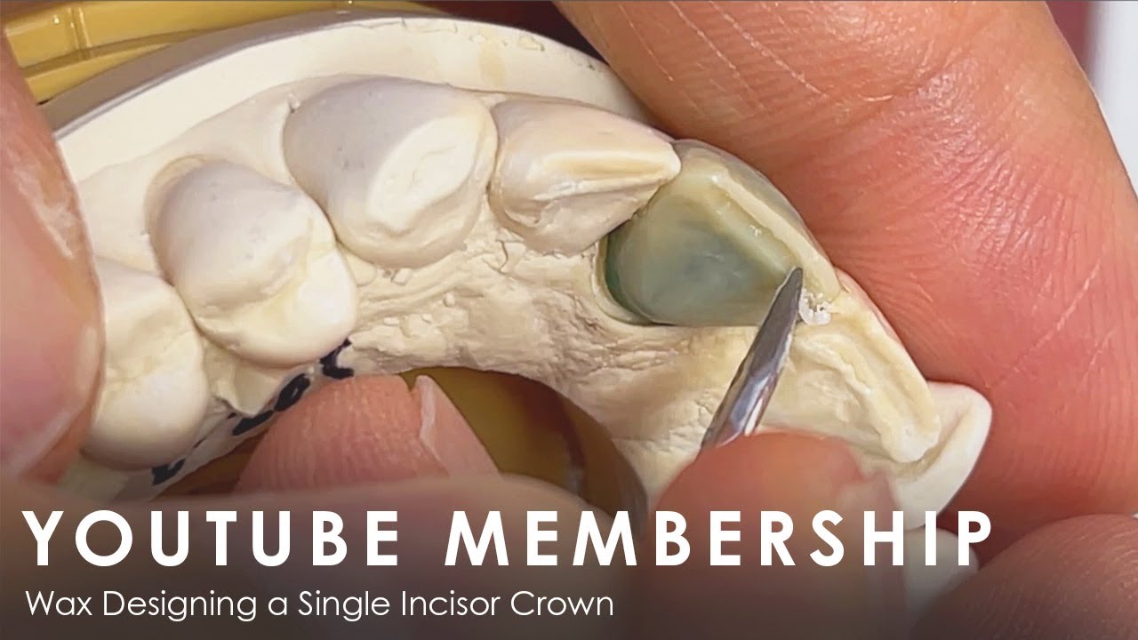 Wax Designing a Single Incisor Crown - YouTube