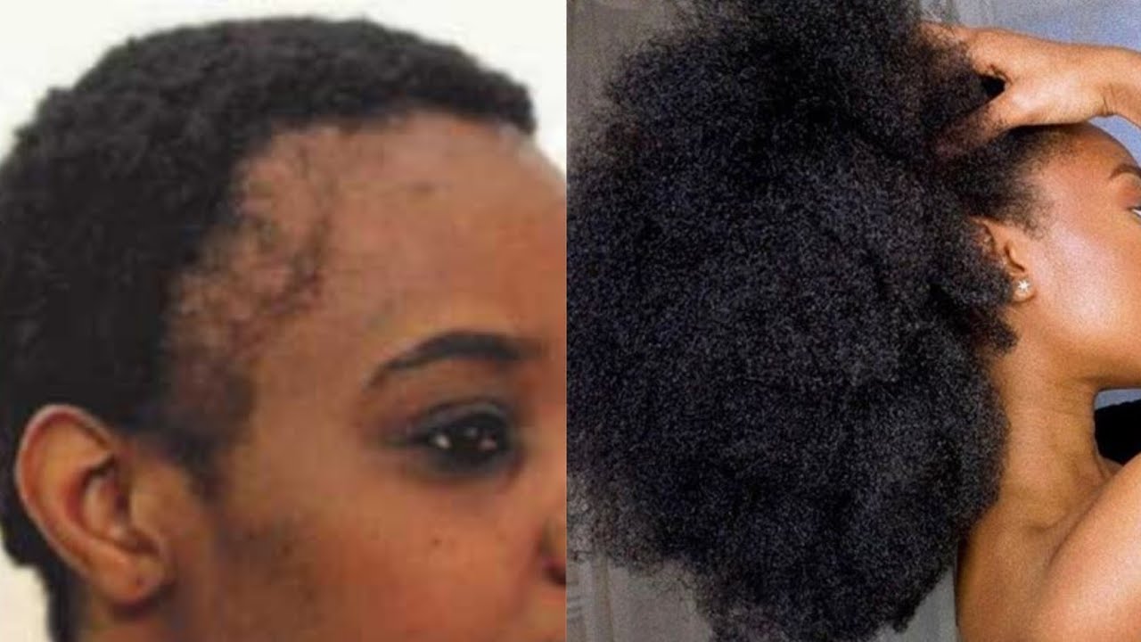 10 choses qu'il faut faire pour éviter la casse de ses cheveux crepus ...