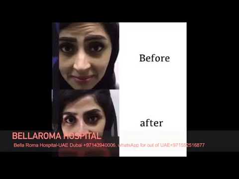 Bella Roma Hospital - YouTube