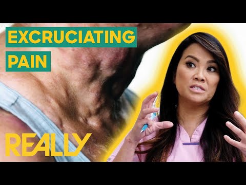 Woman Seeks Dr Lee's Aid To Remove Painful Bumps All Around Her Body | Dr. Pimple Popper: Pop Ups
