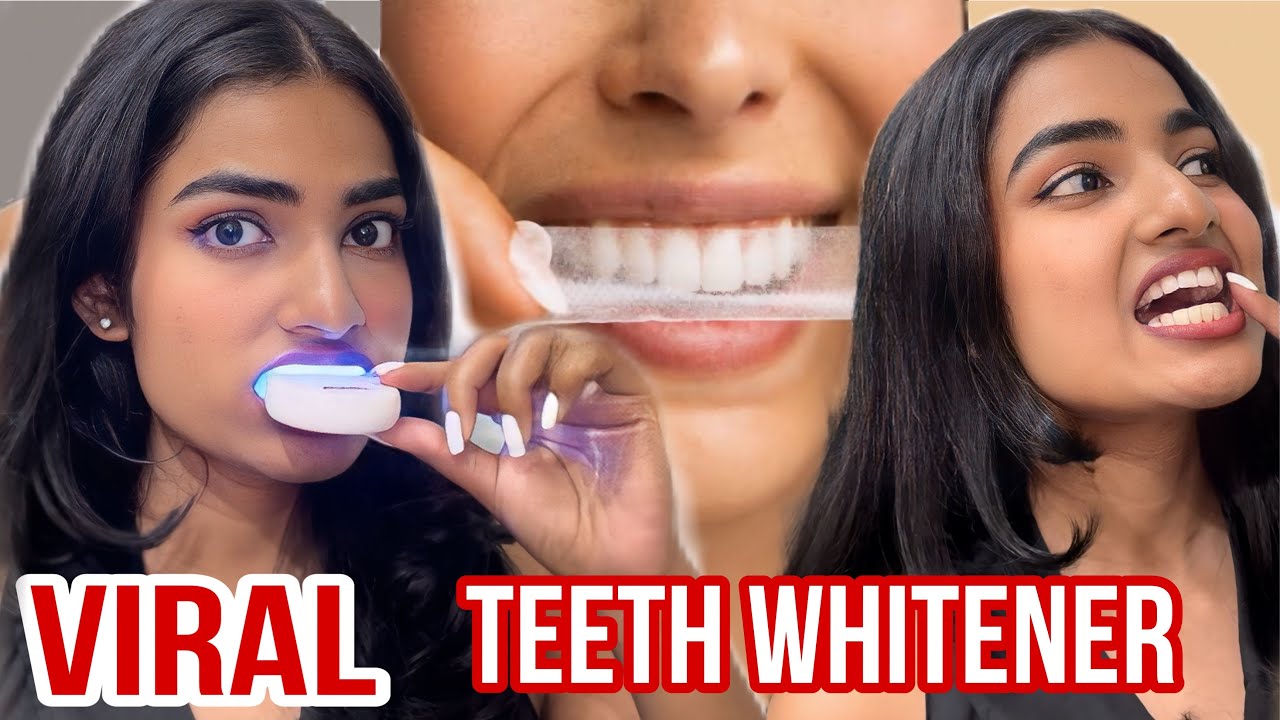I Tried INSTANT TEETH WHITENING AT HOME using strips and LED light ...