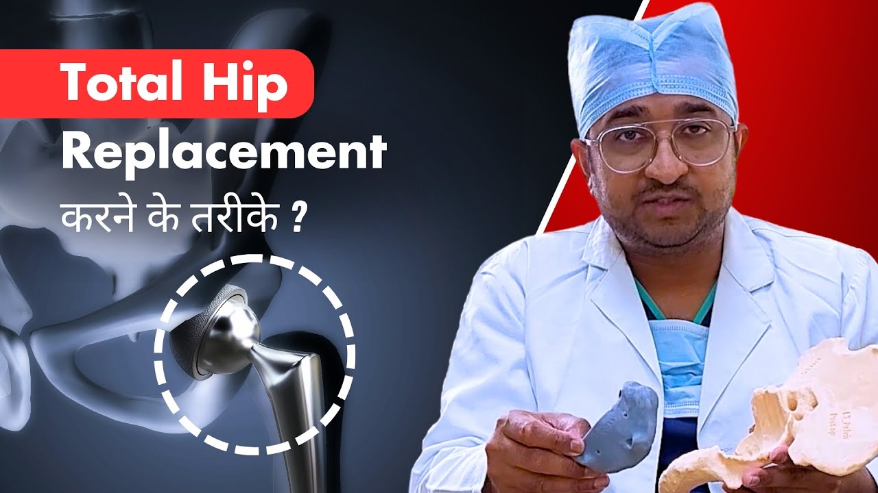 Total Hip Replacement Surgery : Approaches, Revision Surgery & 3D Model | Dr Lokesh Garg - YouTube