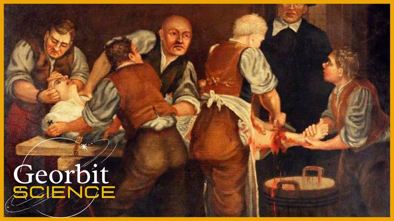 14 Deadly Facts About Victorian Era Surgery - YouTube
