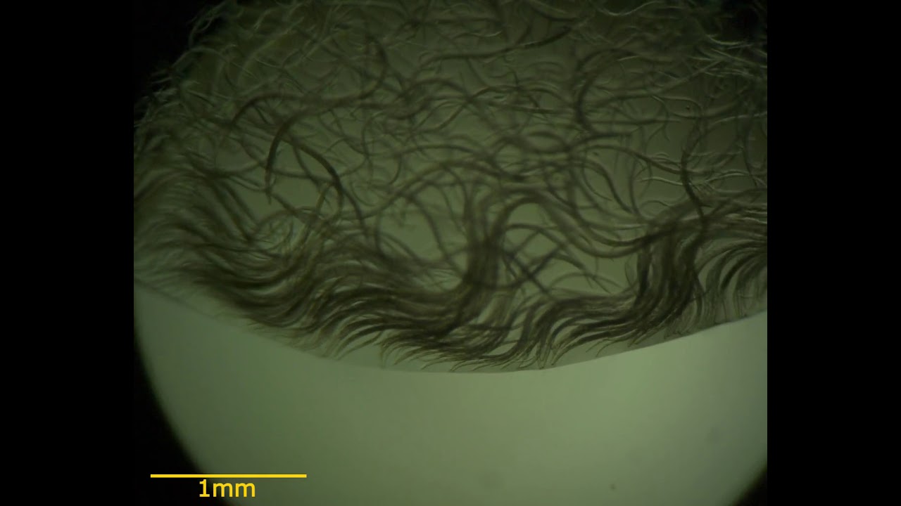 Metachronal waves in Vinegar Eels (Turbatrix Aceti) - YouTube
