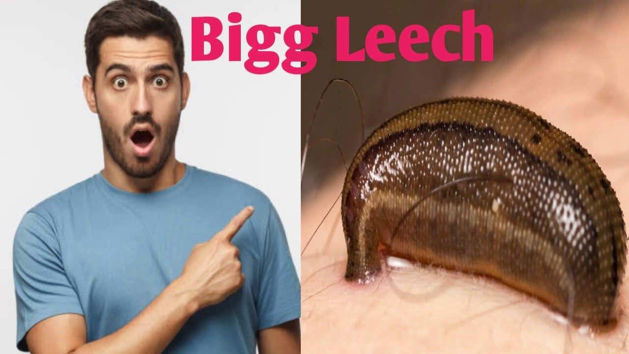 Malnad Bigg Leech video.... - YouTube