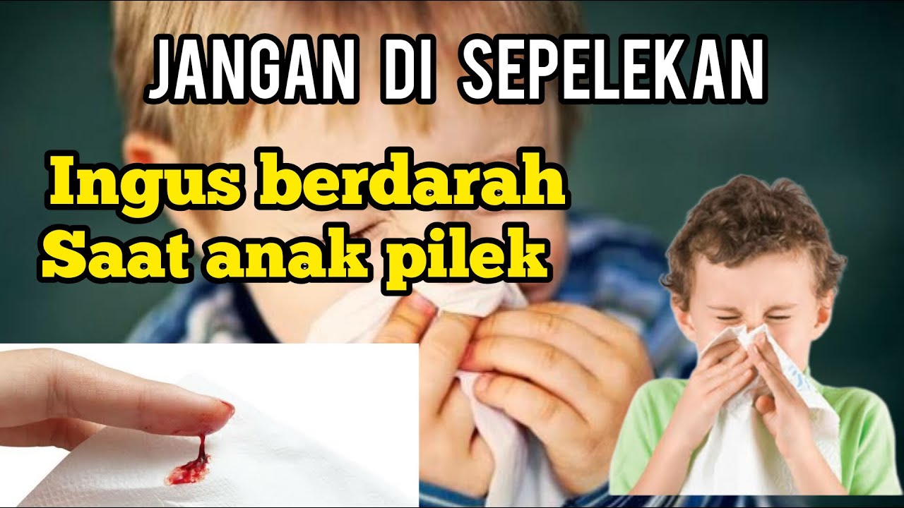 Ingus berdarah saat anak pilek - YouTube
