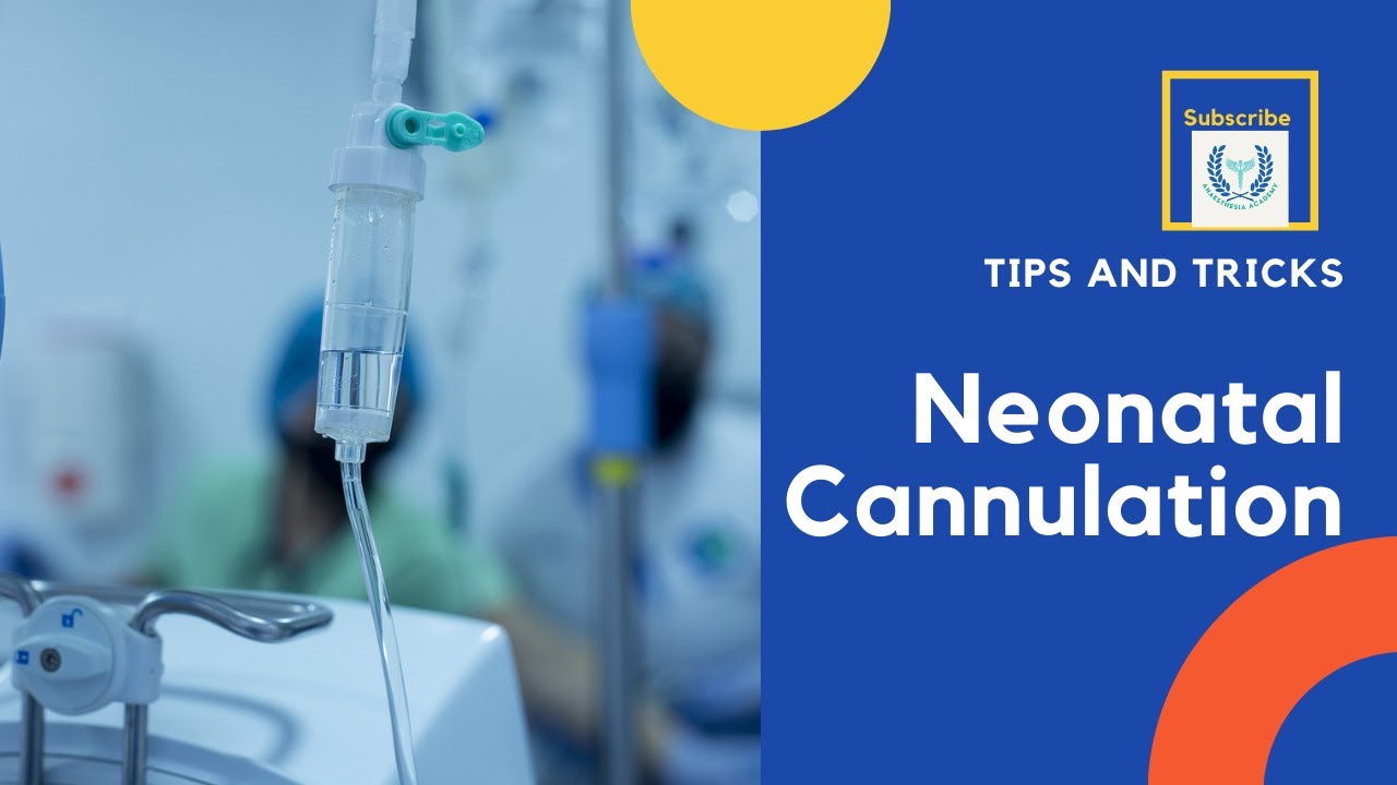 Neonatal intra-venous cannulation made easy with this technique by DR. Kapila Hettiarachchi ...