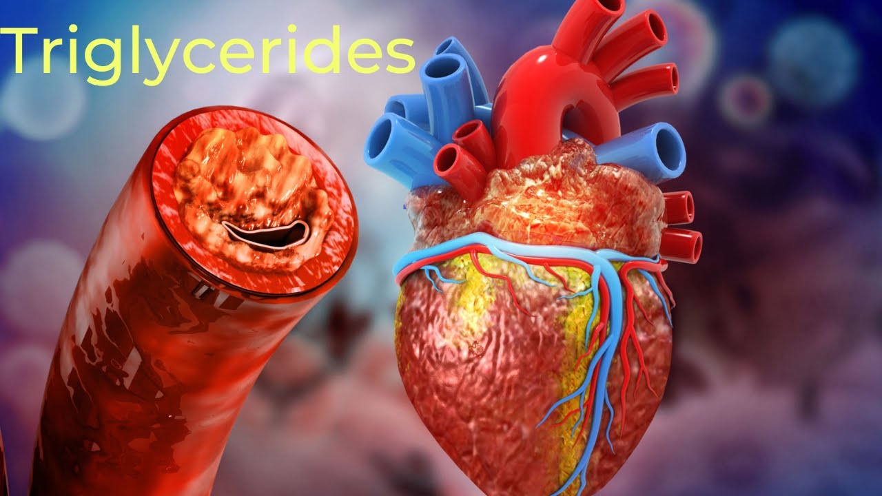 5 High Triglycerides Foods to Avoid | How to reduce triglycerides - YouTube