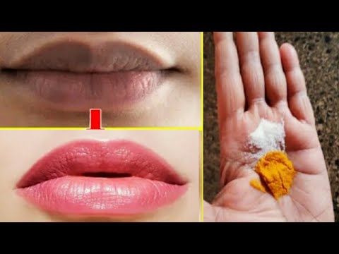 Get Soft Pink Lips Naturally Permanently/100% Works At Home/How To Get ...