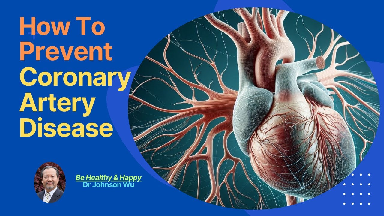How To Prevent Coronary Artery Disease: A Comprehensive Guide for Your ...
