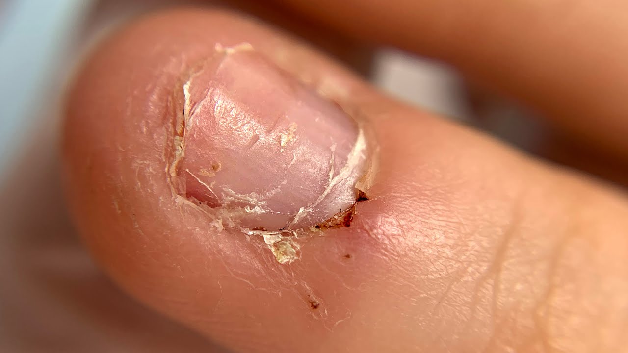 Increíble Transformaión de Uñas Mordidas Después de 3 Manicures - YouTube