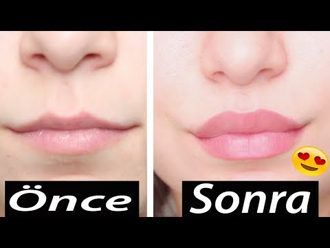 Dudak Nasıl Dolgunlaştırılır Estetiksiz Evde Kolay Yöntem - Güzellik Bakım -