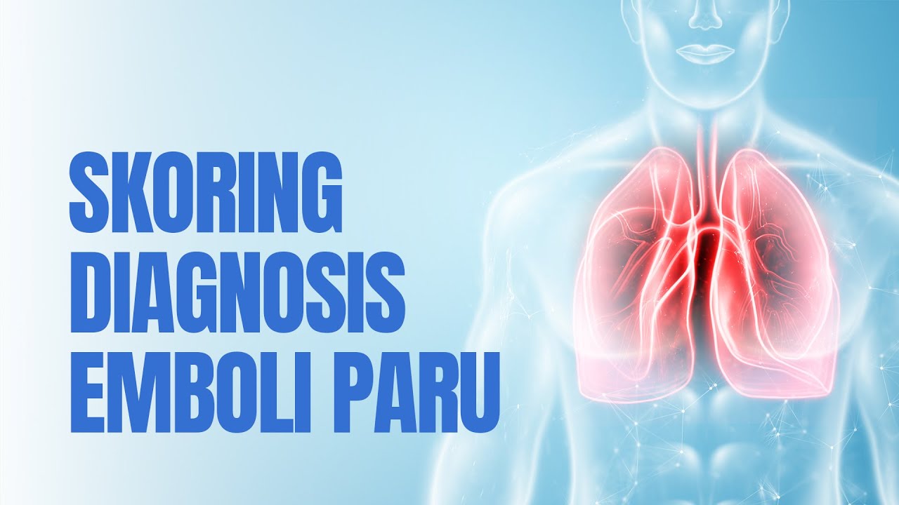 Cara Penilaian untuk Diagnosis Emboli Paru - YouTube