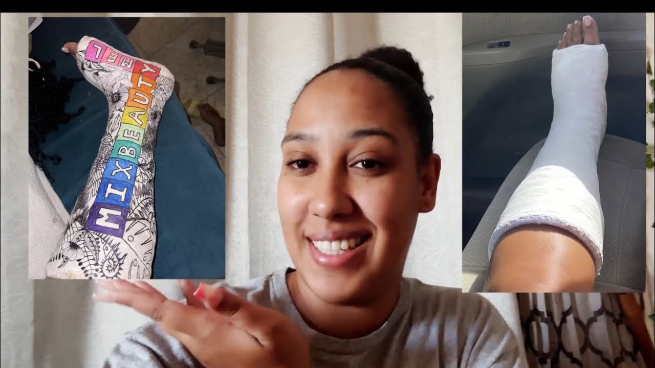 I got bored at home with my broken leg and decided to paint my cast ...