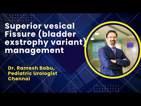 Superior vesicle fissure (variant of bladder exstrophy) repair ...
