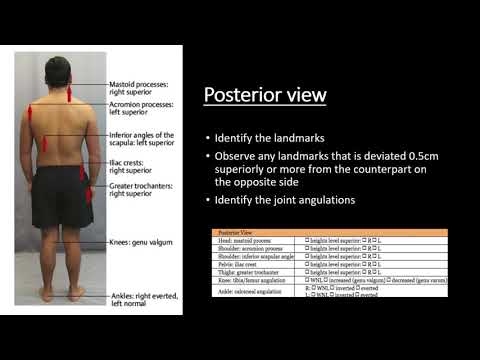 Standing Postural Exam - posterior view - YouTube