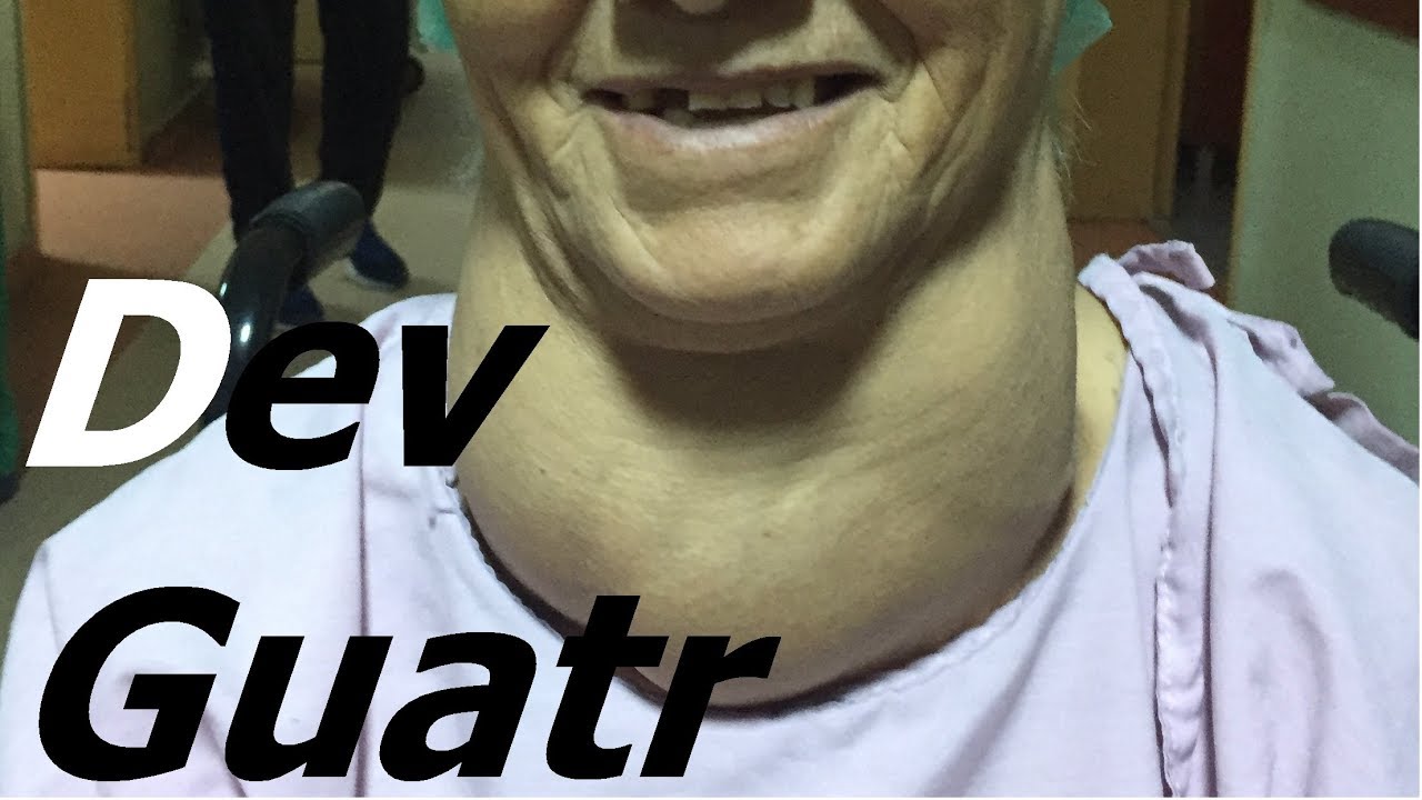 Dev Guatr / Giant Goiter - YouTube