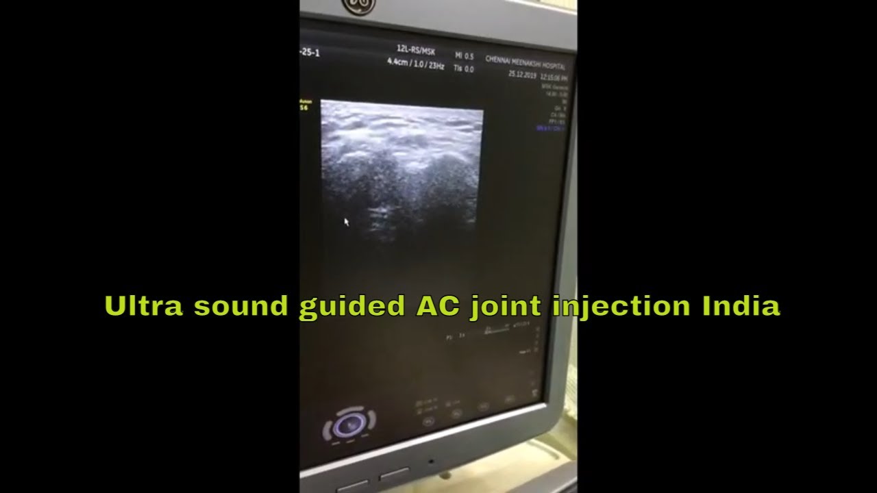 Ultrasound-guided injection of the acromio-clavicular joint Chennai ...