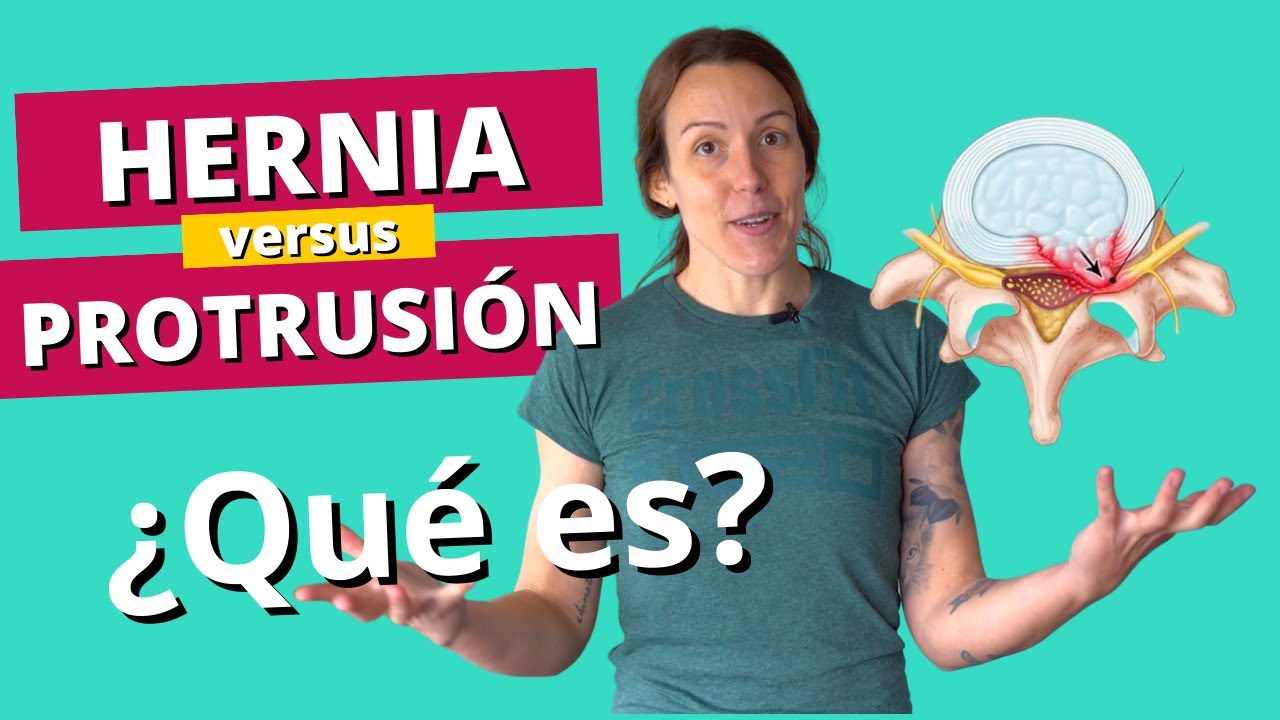 Hernia Discal y Protrusión Discal - ¿Se curan solas? 😱 Todo lo que ...
