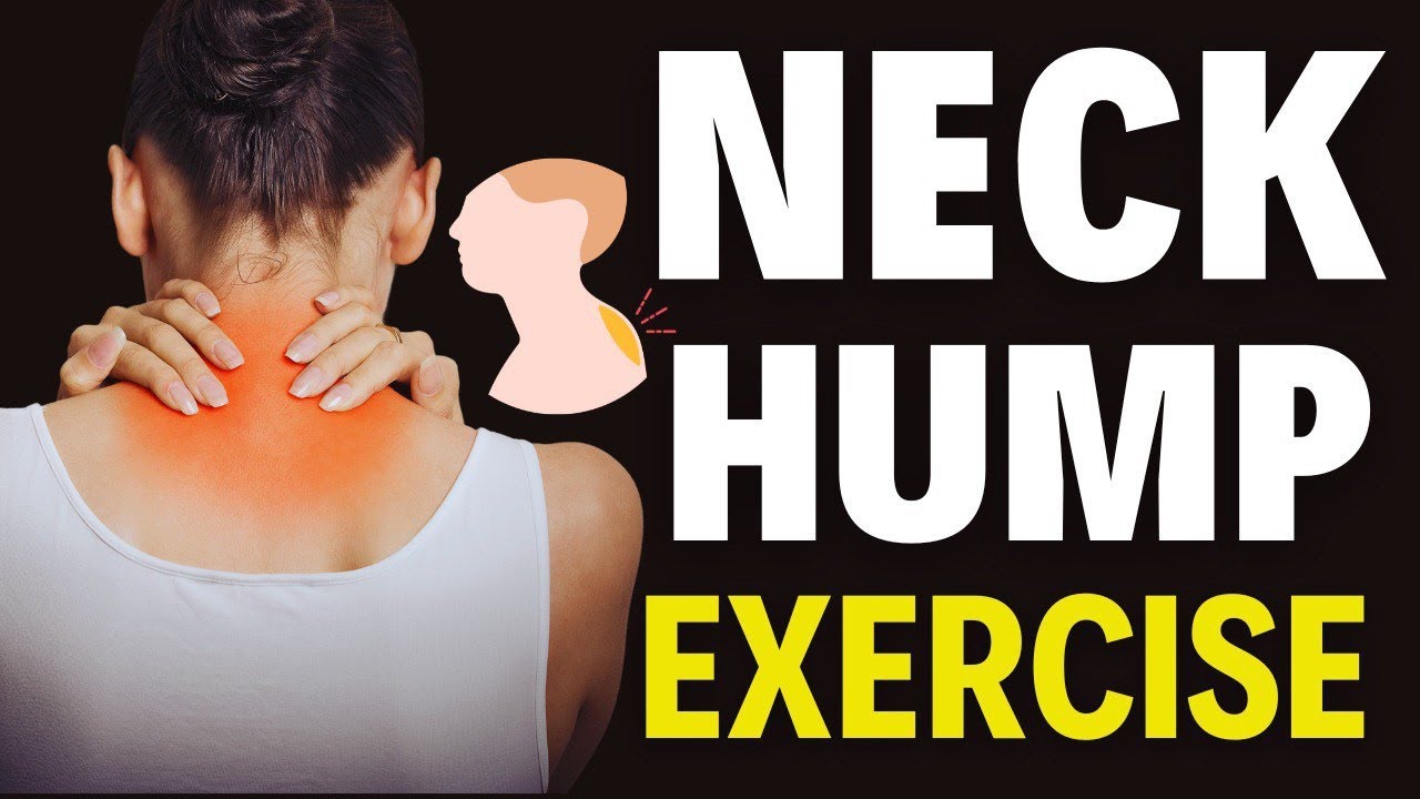 Neck hump exercises at home (Hindi) | Buffalo hump removal Exercise ...