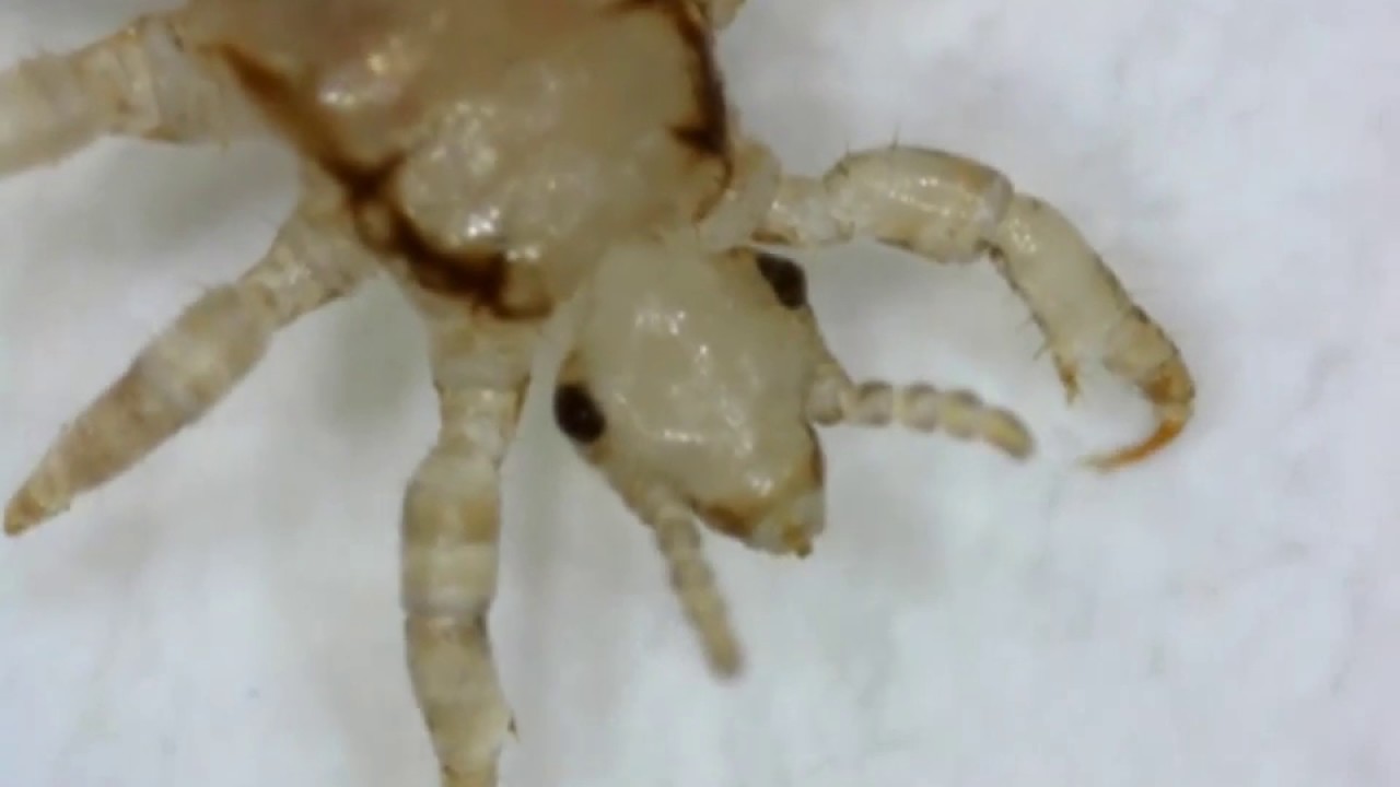 Lice - Poux - Dino-lite digital microscope - YouTube