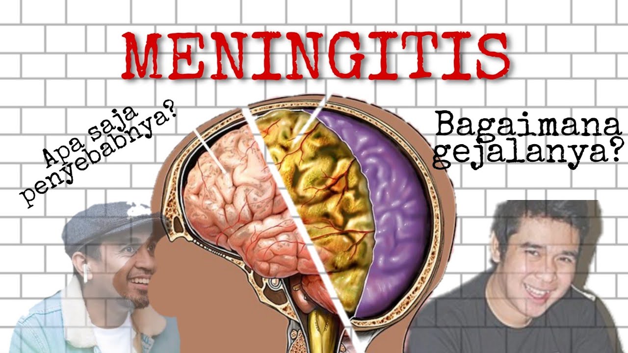 Penyakit Meningitis - YouTube