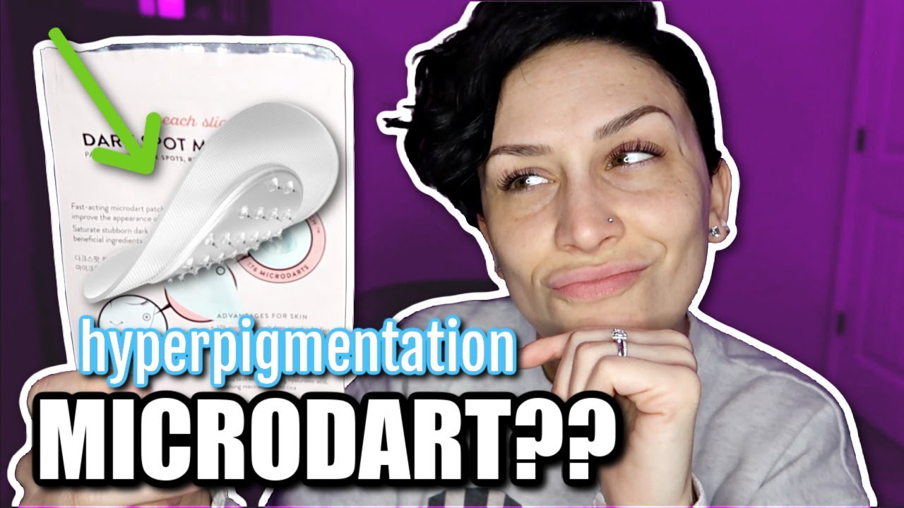 MICRODART for hyperpigmentation? - YouTube