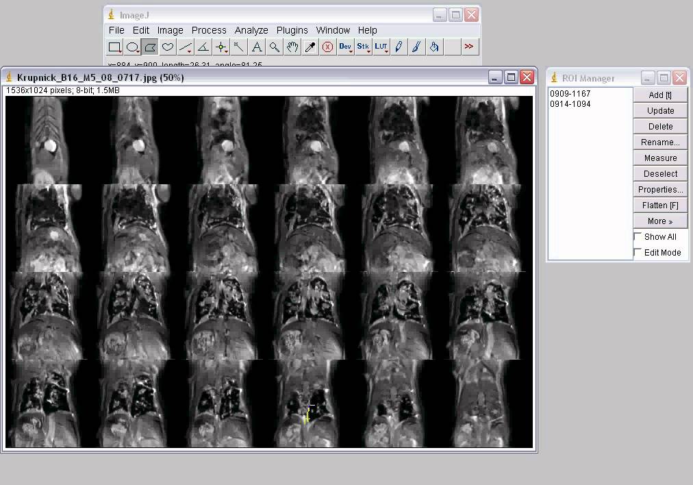 Manual segmentation of mouse lungs using ImageJ. - YouTube