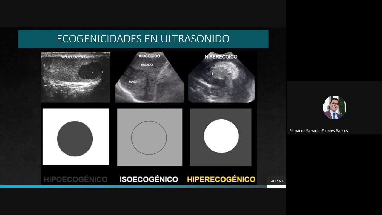 Anatomia Ultrasonografica - YouTube