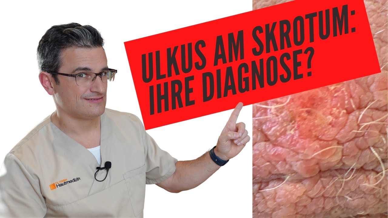 FACHARZTPRÜFUNG DERMATOLOGIE: Geschwür am Skrotum: IHRE DIAGNOSE? - YouTube