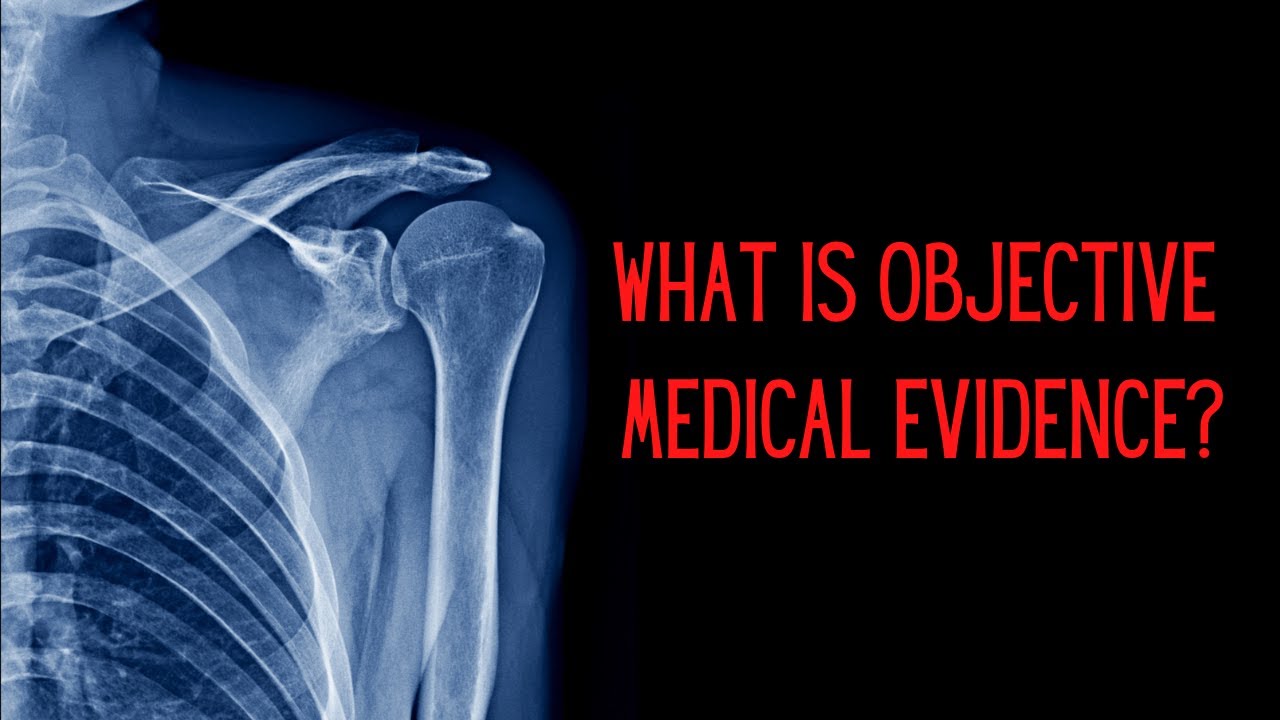 The Edge Series: What is "Objective Medical Evidence?" - YouTube