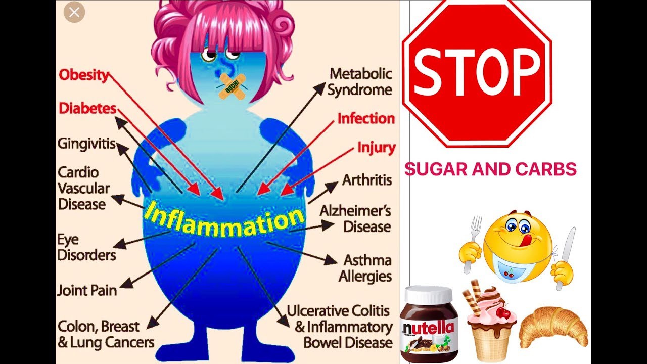 Inflammation - Sugar is Evil 🧟‍♀️🙅🏾‍♀️🤷🏾‍♀️ - Sugar Addiction - YouTube