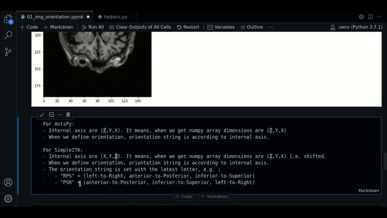 1.1 - MRI image orientation with SimpleITK - Course MRI preprocessing with Python - YouTube
