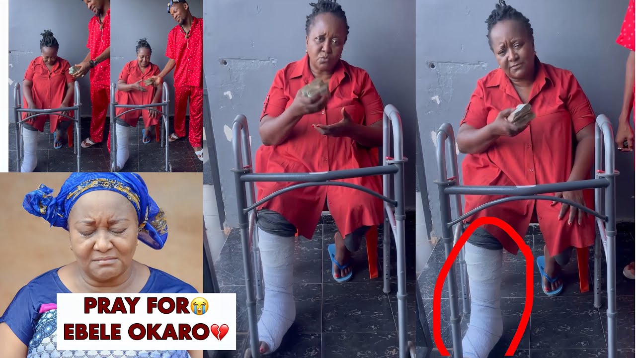 Pray For Actress Ebele Okaro As This Happened To Her, Sad Video💔😭In The Hospital Of Leg Injury ...