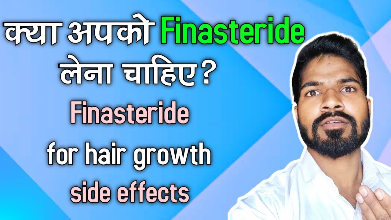 Finasteride 6 month use after Review | Finasteride tablet hair growth ...