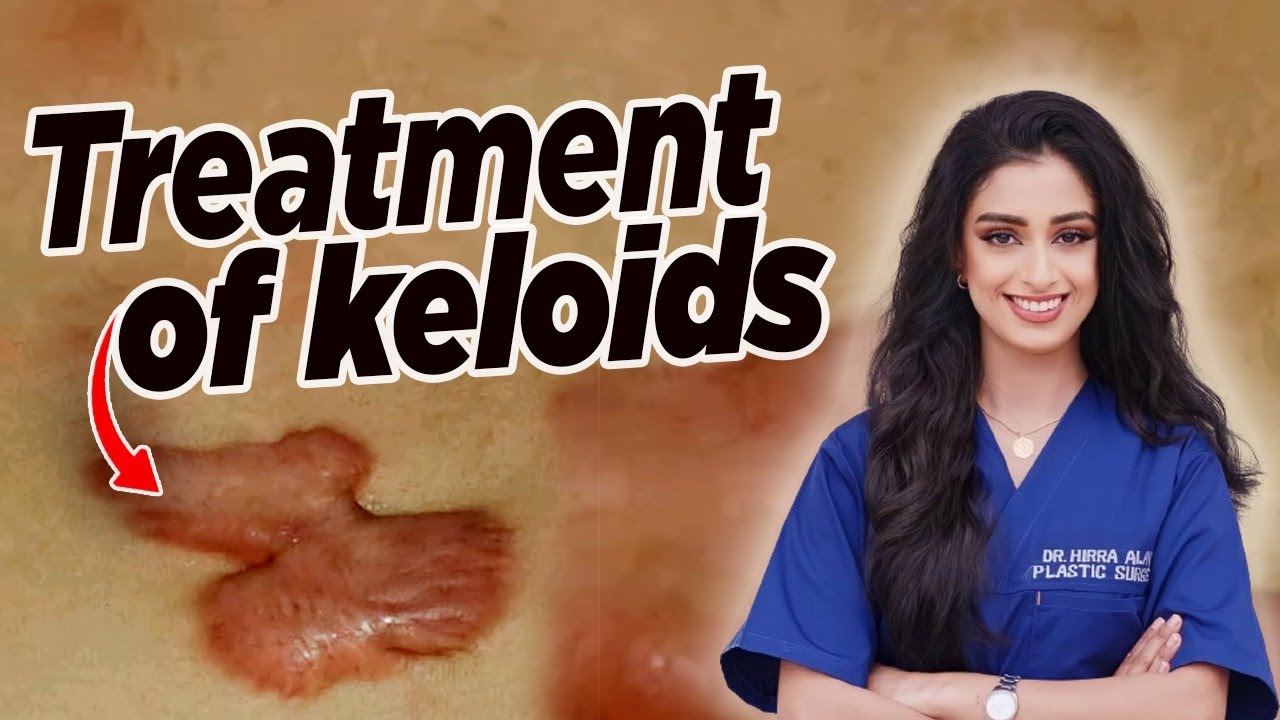 DOCTOR explains keloid scar treatment- Dr. Hirra Alavi - YouTube