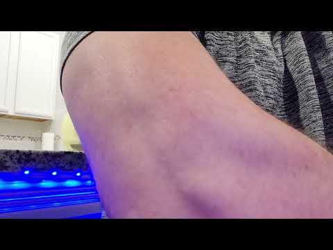 Muscle Cramp in Arm after workout Pain - YouTube
