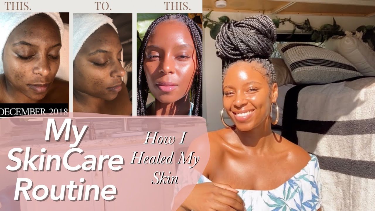 SkinCare Routine | How I Healed My Acne | Van Life Edition - YouTube