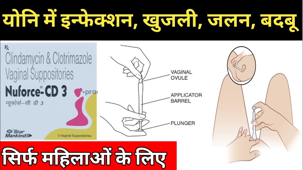 Nuforce cd3 Vaginal suppository- clindamycin and clotrimazole suppository - YouTube