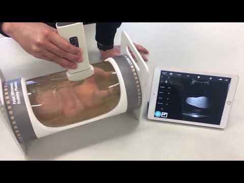 New images of our Baby-Scanner! - YouTube