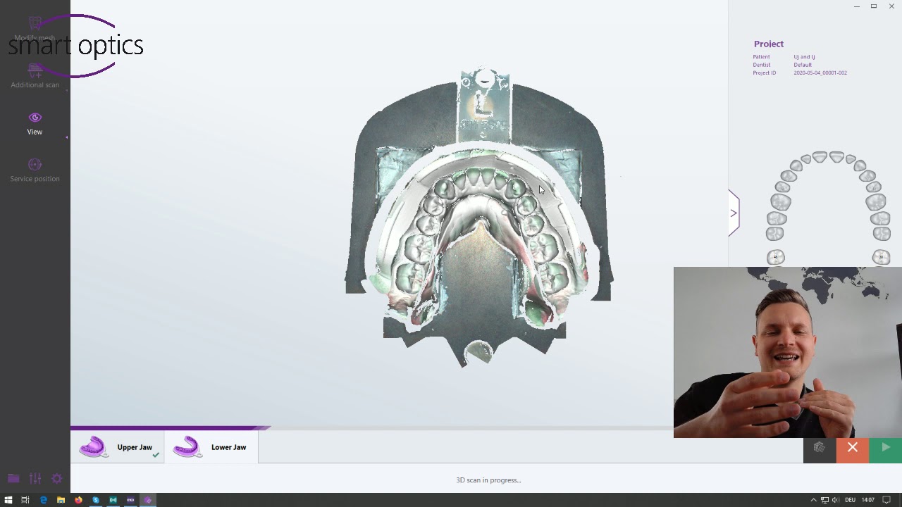 Upper and lower jaw impression scan with alignment in exocad - YouTube