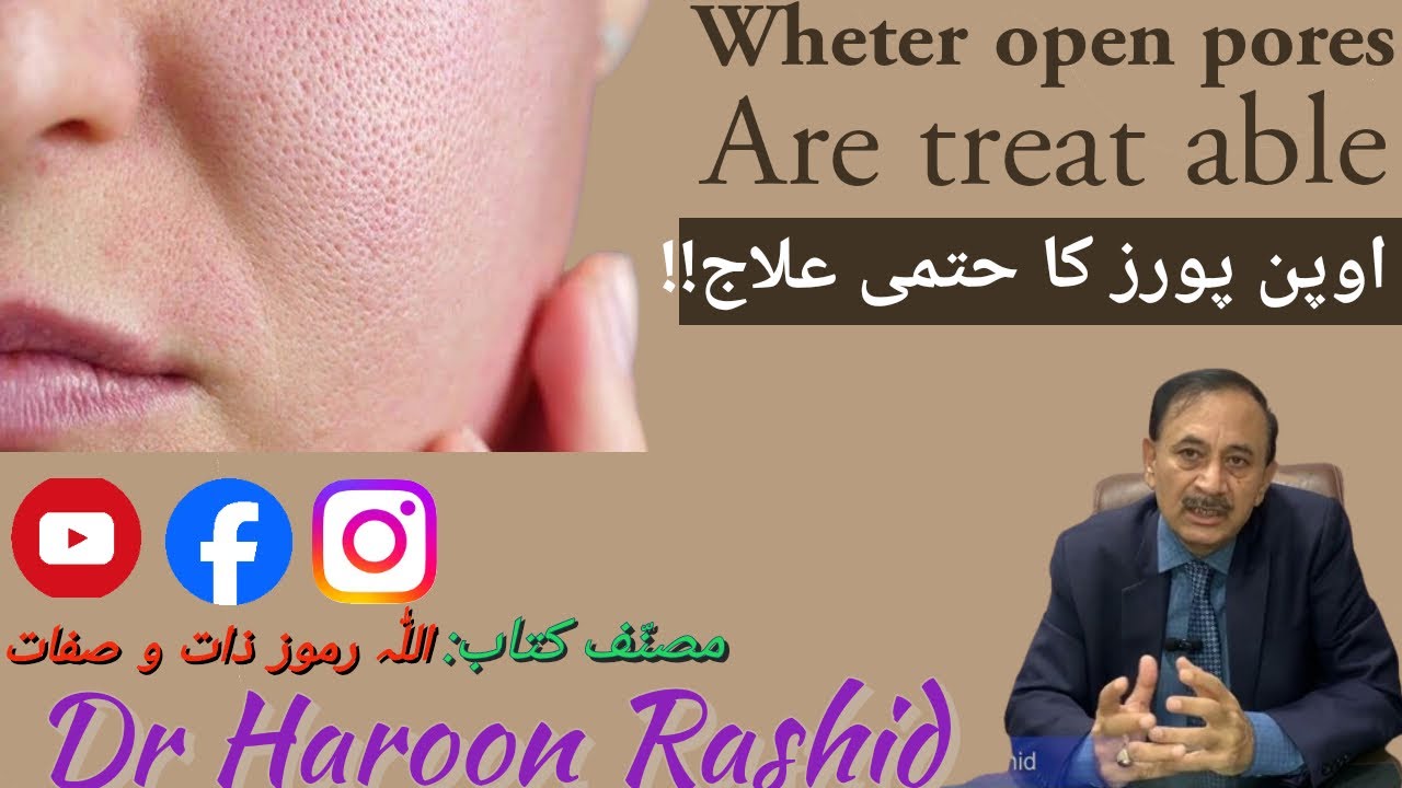 Solution of open pores by Dr Haroon Rashid skp |open pores theik karna ...