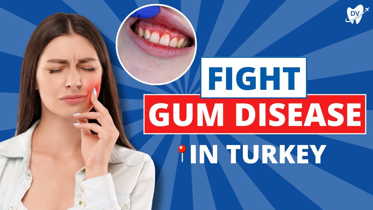 Causes, Warning Signs & Treatment of Gum Disease in Turkey - YouTube